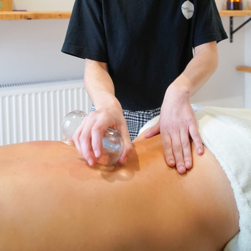 Understanding the Benefits of Dry Cupping | Natural Healing